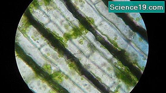 ¿Por qué los cloroplastos se mueven en Elodea? 💫 Portal Multimedia ...